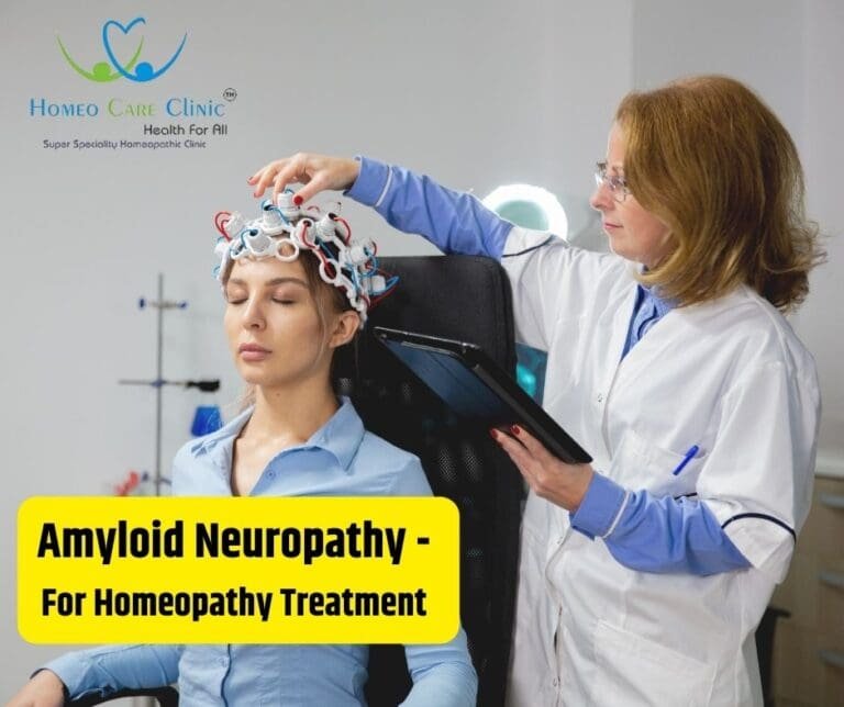 Homeopathy for Amyloid Neuropathy: Holistic Healing and Symptom Relief