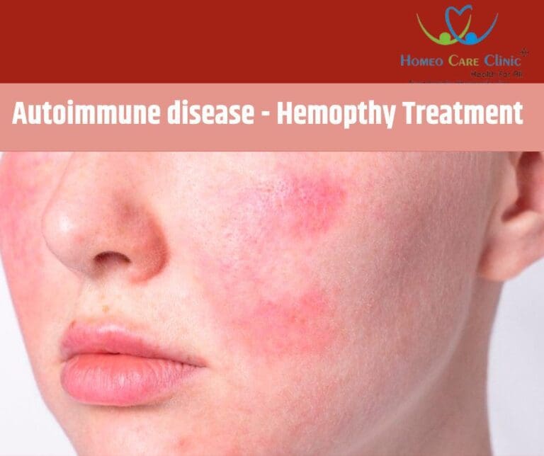 Homeopathic Treatment for Autoimmune Diseases - Homeo Care Clinic