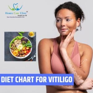 Vitiligo Diet Chart: Foods to Eat & Avoid for Skin Health