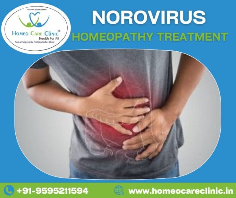 Norovirus: Symptoms, Causes and Its Homeopathic Treatment