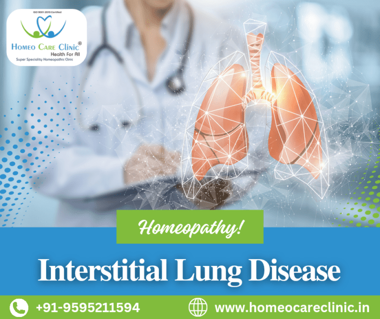 Homeopathy Treatment for Interstitial Lung Disease (ILD) | Homeo Care ...