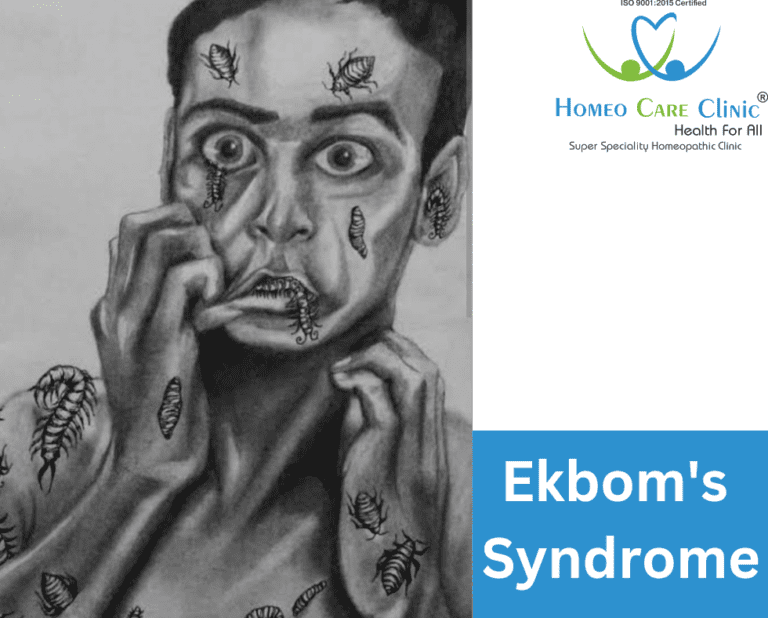 Ekbom Syndrome : Causes, Symptoms & Homeopathy Treatment - Homeo Care ...