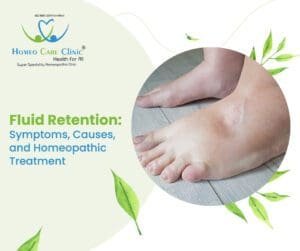 Fluid Retention: Symptoms, Causes, and Homeopathic Treatment ...