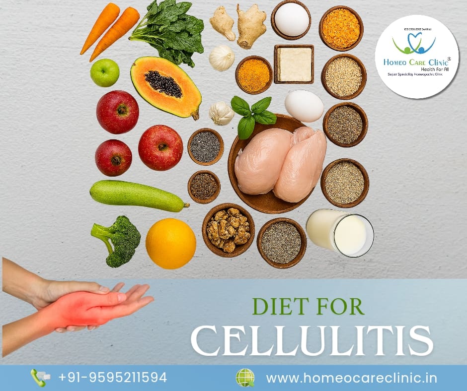 Diet for Cellulitis – Foods to Boost Immunity and Support Healing