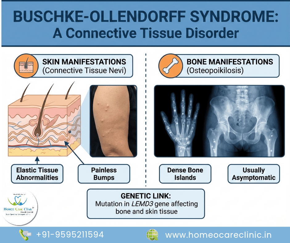 Buschke-Ollendorff Syndrome: Causes, Symptoms & Treatment Guide